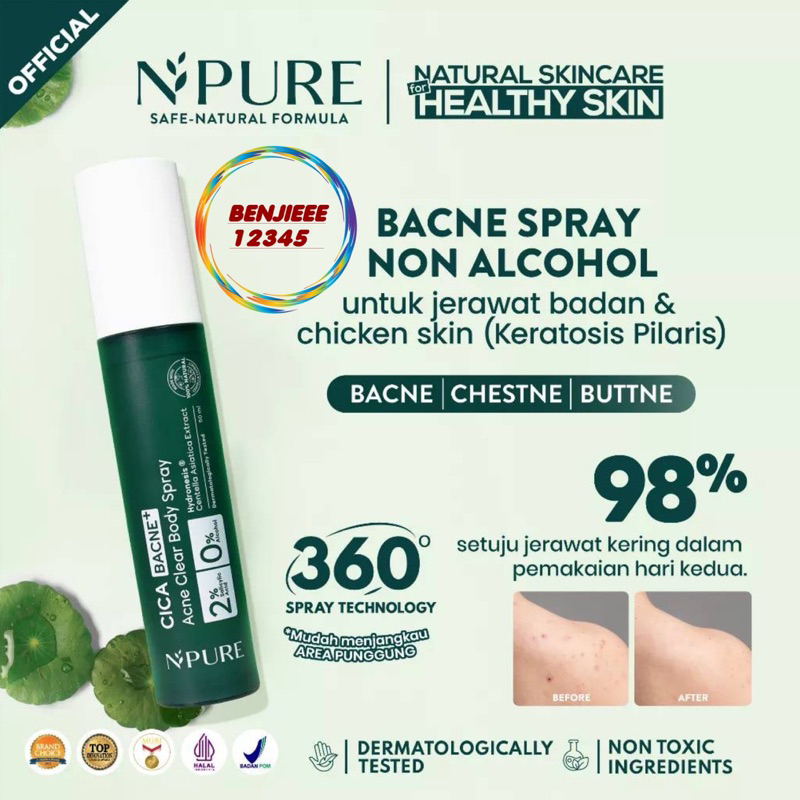 Jual npure BACNE spray jerawat punggung badan N’pure bacne chicken skin ...