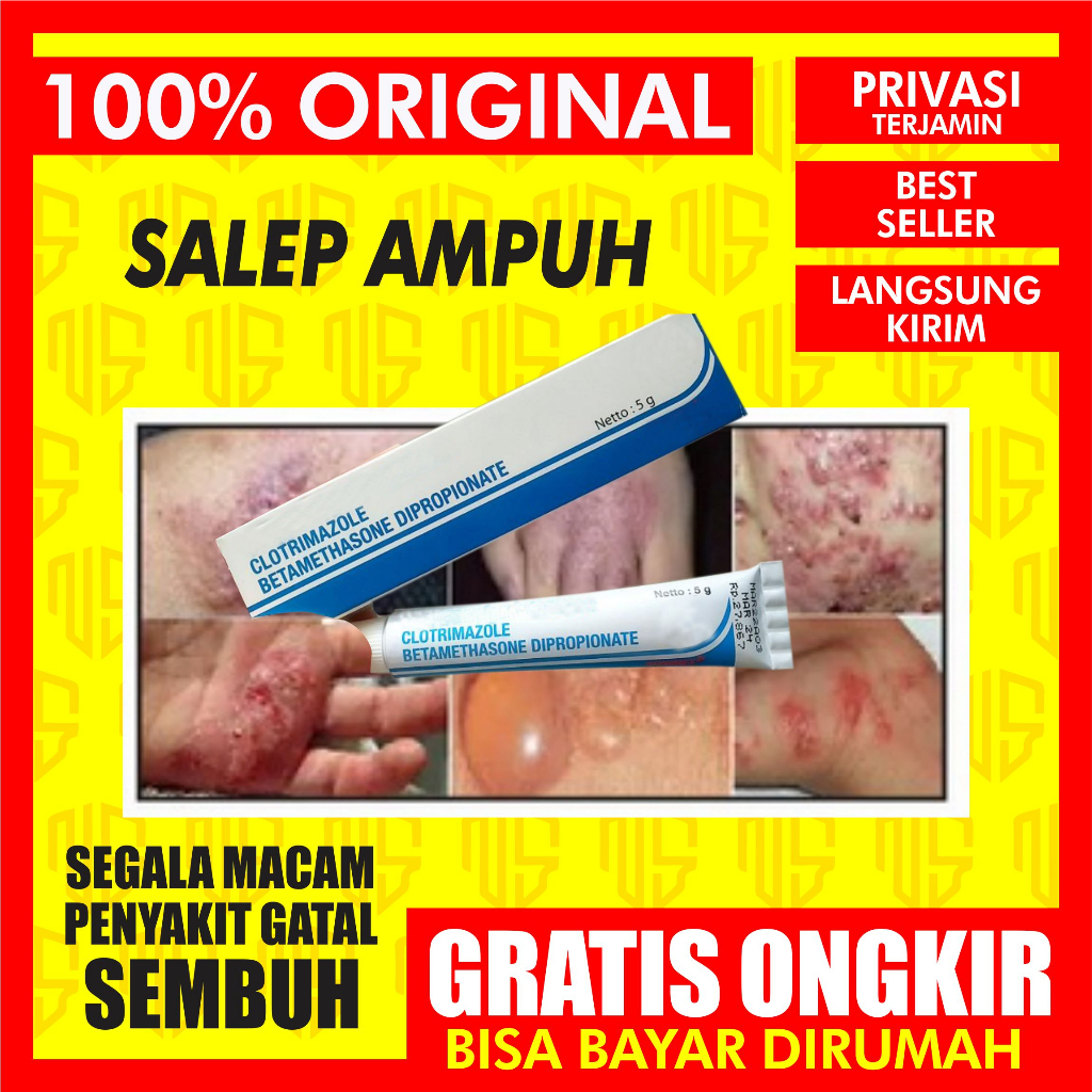 Jual Salep Hel. tiskin Gatal, Eksim, jamur, Alergi, Panu, kadas, Kurap ...