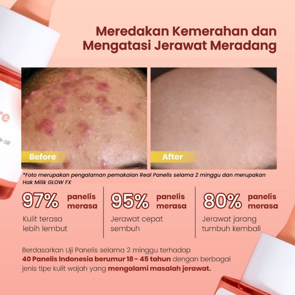 Jual [Clear Skin Bundle] 1 PCS GLOW FX Acne Pure Serum + 1 PCS GLOW FX ...