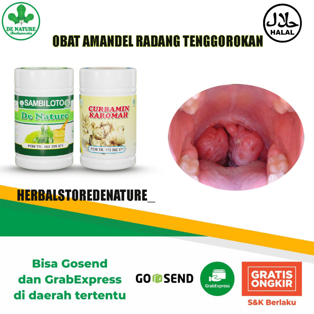 Jual Obat Amandel Anak Dewasa Paling Ampuh Penyakit Radang Tenggorokan ...
