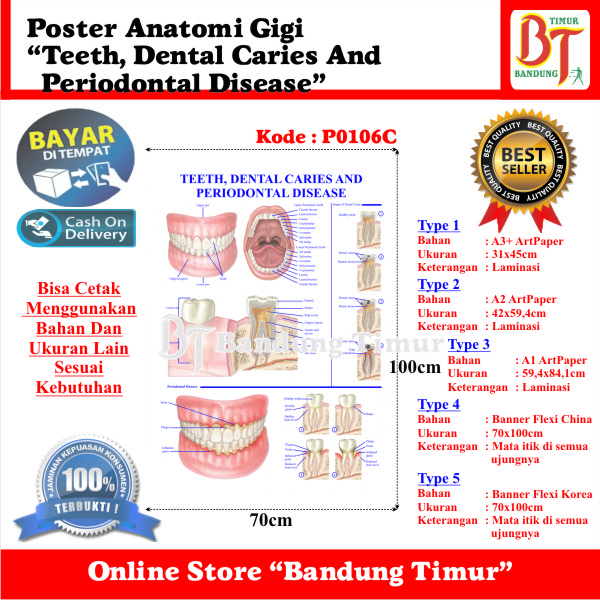 Jual POSTER ANATOMI GIGI - TEETH DENTAL CARIES AND PERIODONTAL DISEASE ...
