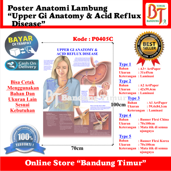 Jual POSTER ANATOMI LAMBUNG - UPPER GI ANATOMY AND ACID REFLUX DISEASE ...