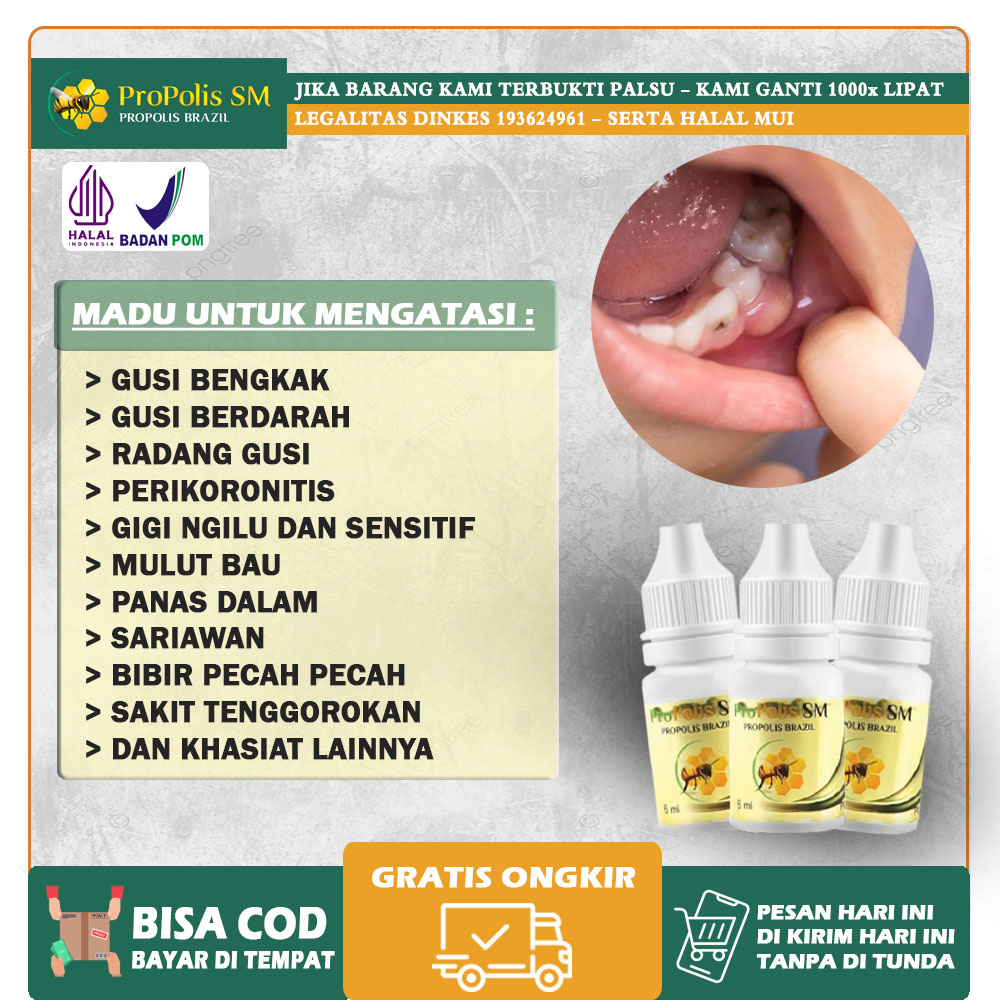 Jual Obat Gusi Bengkak Sakit Gigi Berlubang Radang Gusi Gigi ...