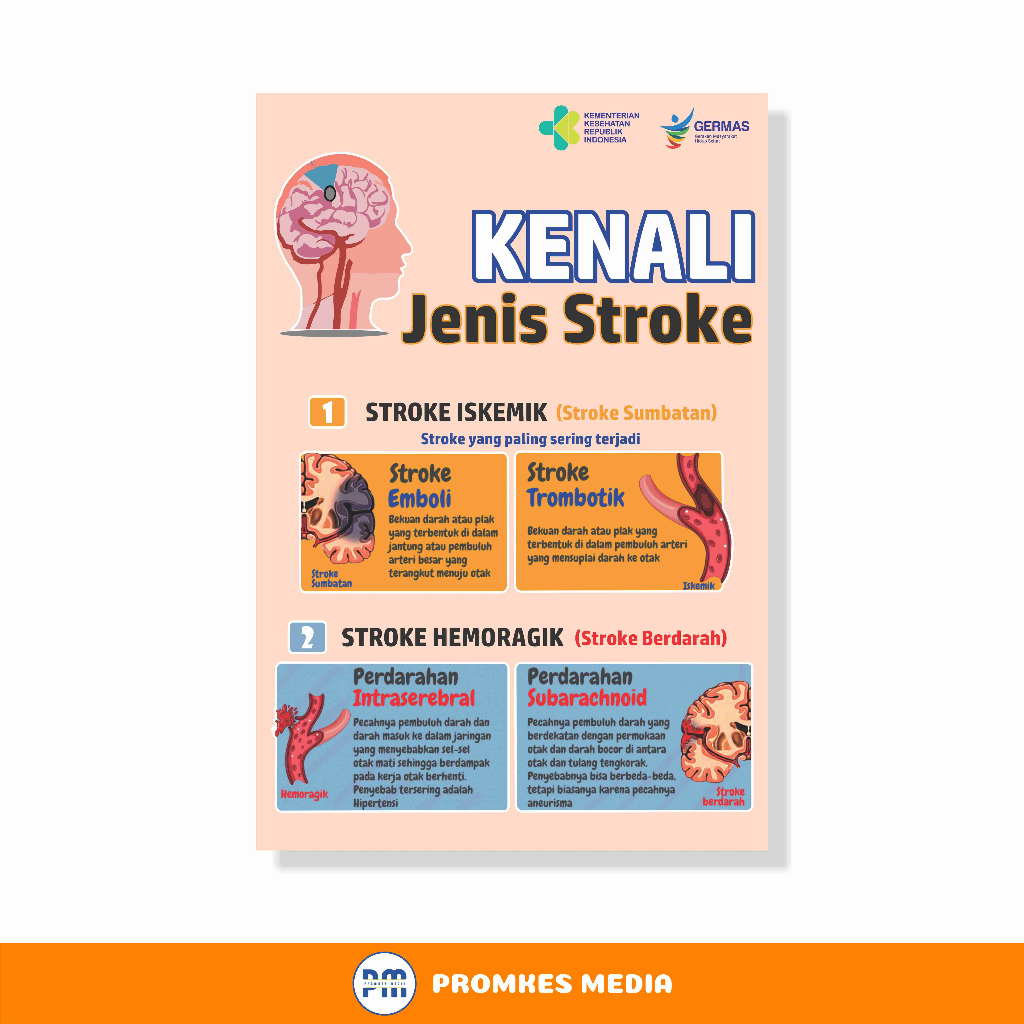 Jual Poster Kesehatan, Kenali Jenis Stroke | Shopee Indonesia