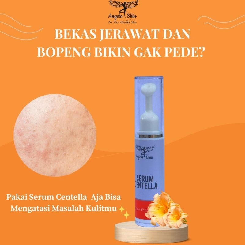 Jual Angela Skin Serum Centella | Shopee Indonesia