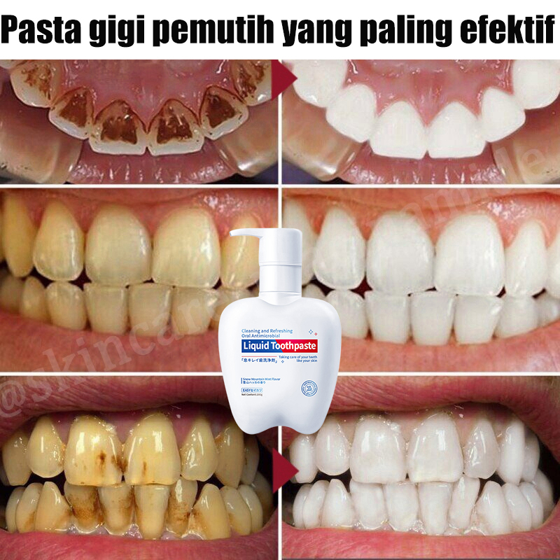 Jual Jepang Pemutih gigi Teeth whitening Pasta gigi sensitif 200g ...
