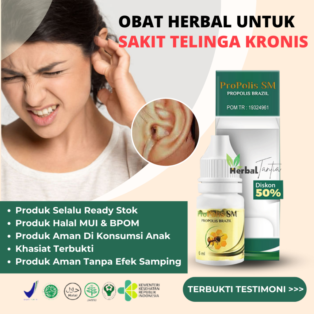 Jual Propolis SM Brazilian Asli Untuk Telinga Berair Berdengung Congek ...