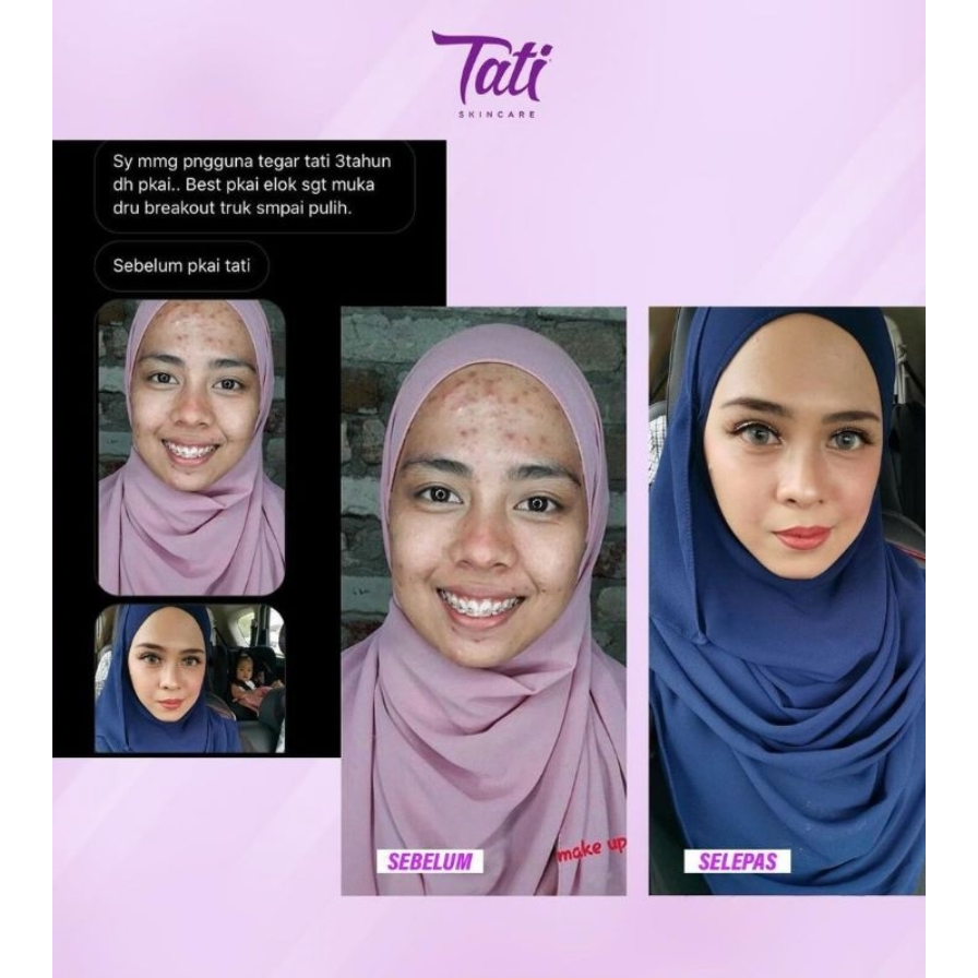 Jual BANTING HARGA TERMURAH PAKET CREAM TATI SKINCARE ORIGINAL / TATI ...