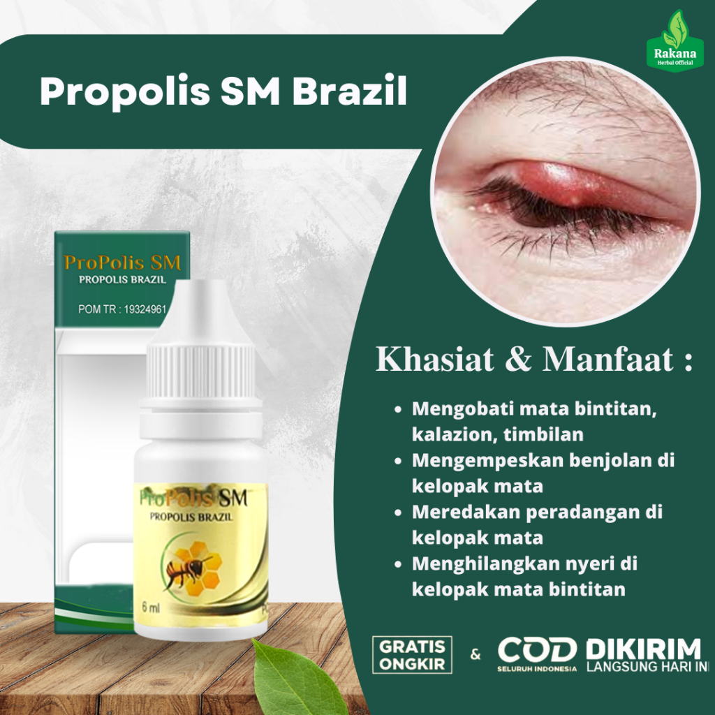 Jual PROPOLIS SM Obat Herbal Benjolan Di Kelopak Mata / Cairan Benjolan ...