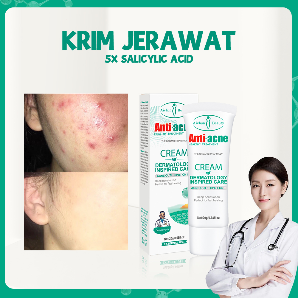 Jual 【beli 2 gratis 1】Aichun Krim Jerawat Krim Salicylic Acid Acne Spot ...