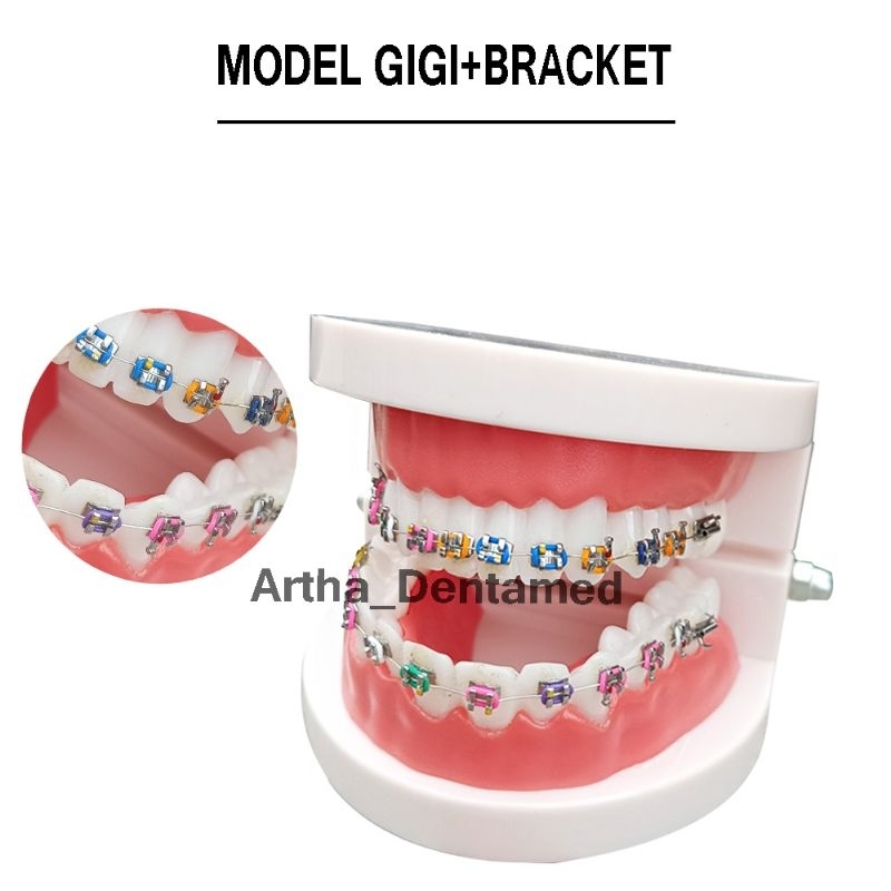 Jual DENTAL PHANTOM MODEL GIGI / STUDY EDUKASI RAHANG GIGI | Shopee ...