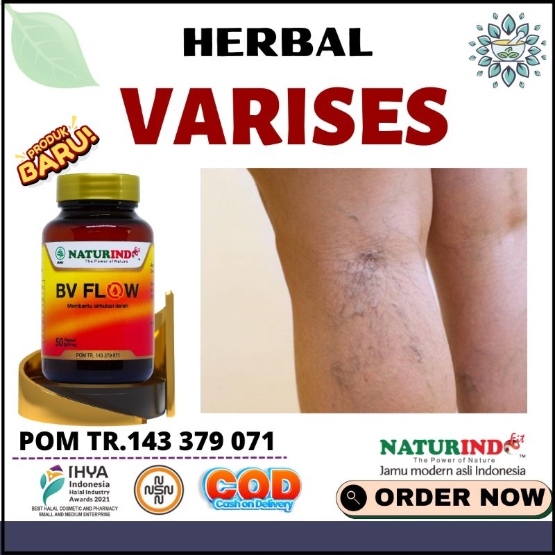 Jual Obat Varises Farises di Kaki Betis Tangan Paha Penyumbatan ...