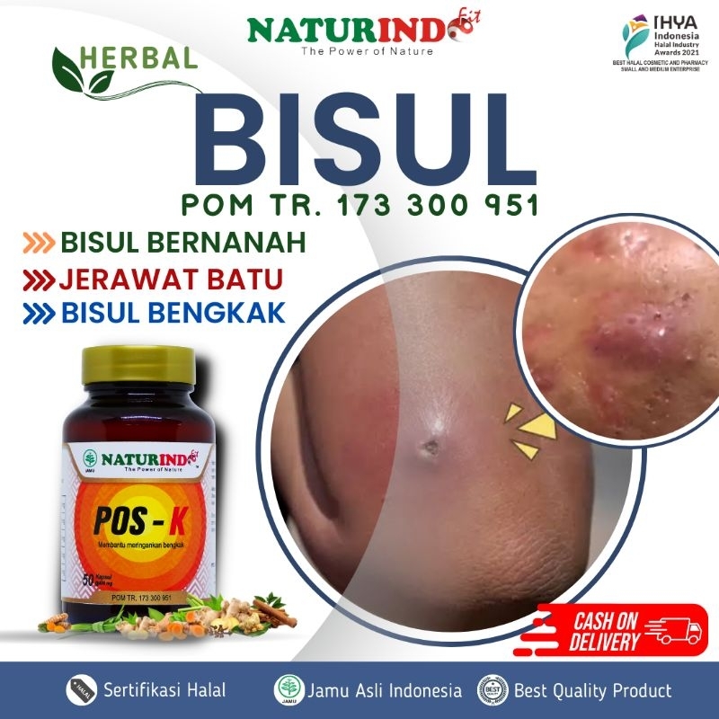 Jual Obat Bisul Bernanah Bisul Bengkak Bisul Pecah Berdarah Cenang ...