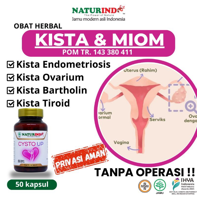 Jual Obat kista dan miom myom Herbal Coklat Kista endometriosis cysta ...
