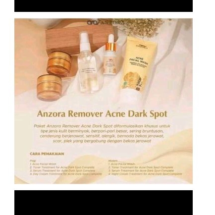 Jual paket ADS anzora | Shopee Indonesia