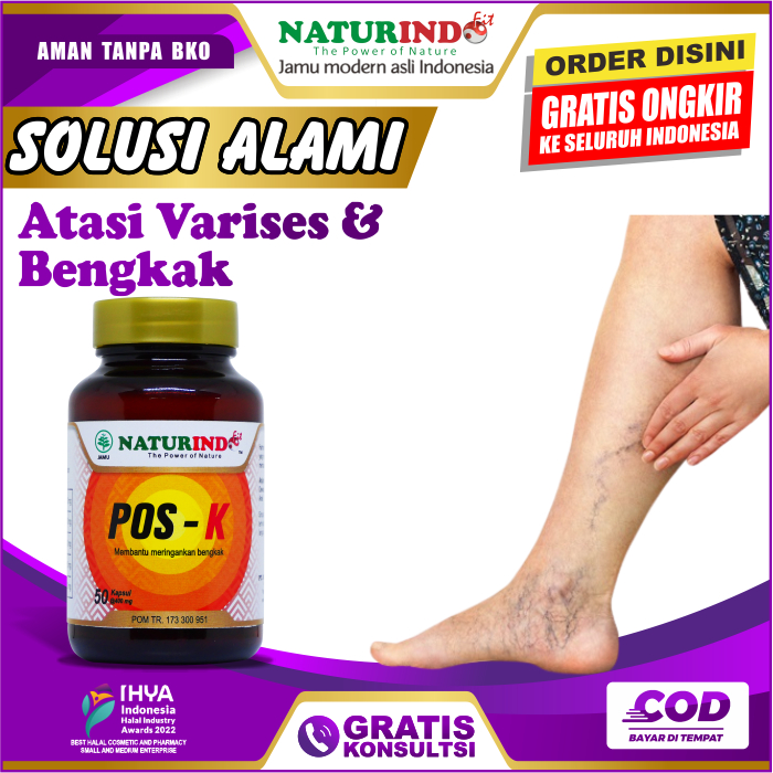 Jual POSK OBAT VARISES DI KAKI DAN BETIS PARISES KAKI FARISES TANGAN ...
