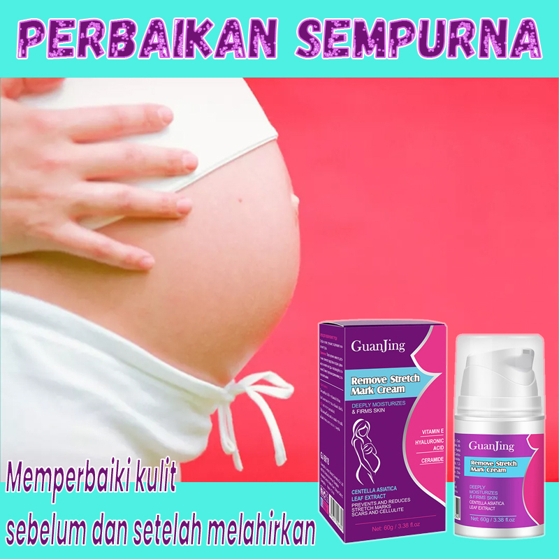 Jual Guanjing Krim Stretch Mark, krim perut, stretch mark kehamilan ...