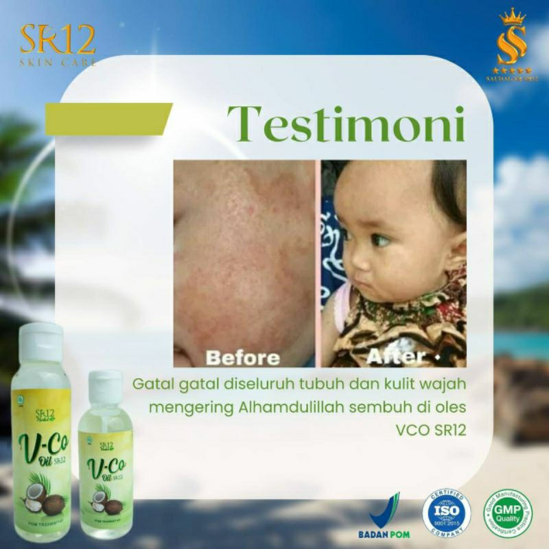Jual vco oil 250 ml | Shopee Indonesia