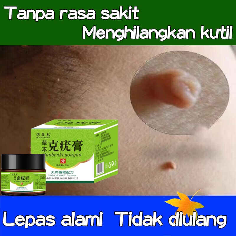 Jual Krim kutil obat penghilang kutil penghilang kutil 20g skin tag ...