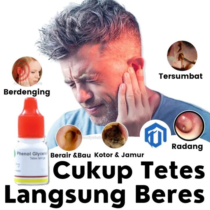 Jual Obat Tetes Telinga Kotoran Keras Tersumbat Berair Gatal Sakit Bau ...