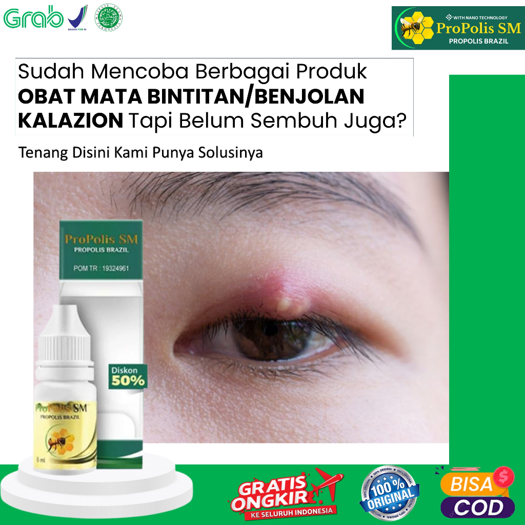 Jual Obat Mata Bintitan Benjolan di Kelopak Mata Benjolan Kalazion Obat ...