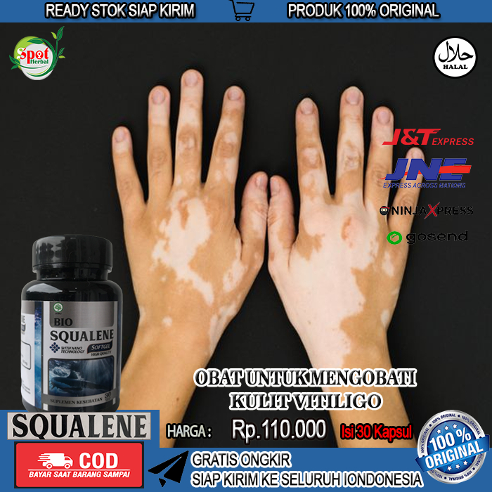 Jual Obat Vitiligo Kulit Kasar, Obat Kulit Bercak Putih Vitiligo, Bio ...