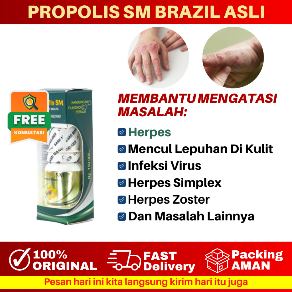 Jual Obat Herpes, Herpes Genital, Herpes Zoster, Cacar Api, Cacar Air ...