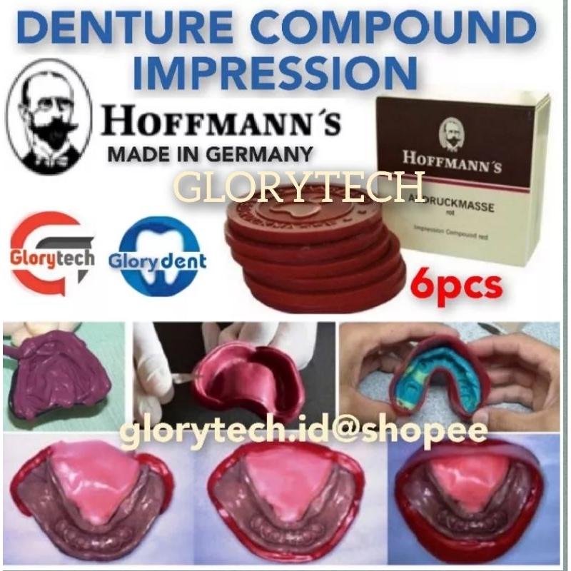 Jual HOFFMANNS IMPRESSION COMPOUND THERMOPLASTIC IMPRESSION /KARET UKUR ...