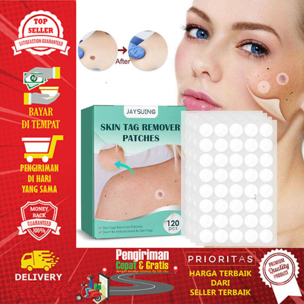 Jual Stiker Penghilang Kutil dan Tahi Lalat / Wart Removal Patch 120 ...