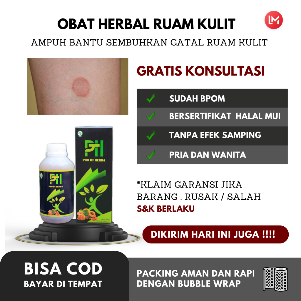 Jual Obat Ruam Kulit Dewasa, Obat Ruam Kulit Anak, Obat Gatal Resep ...