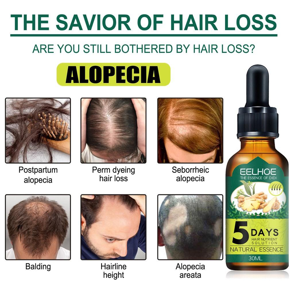 Jual Eelhoe Hair Growth Serum Penumbuh Rambut Wanita Pria Secara Cepat