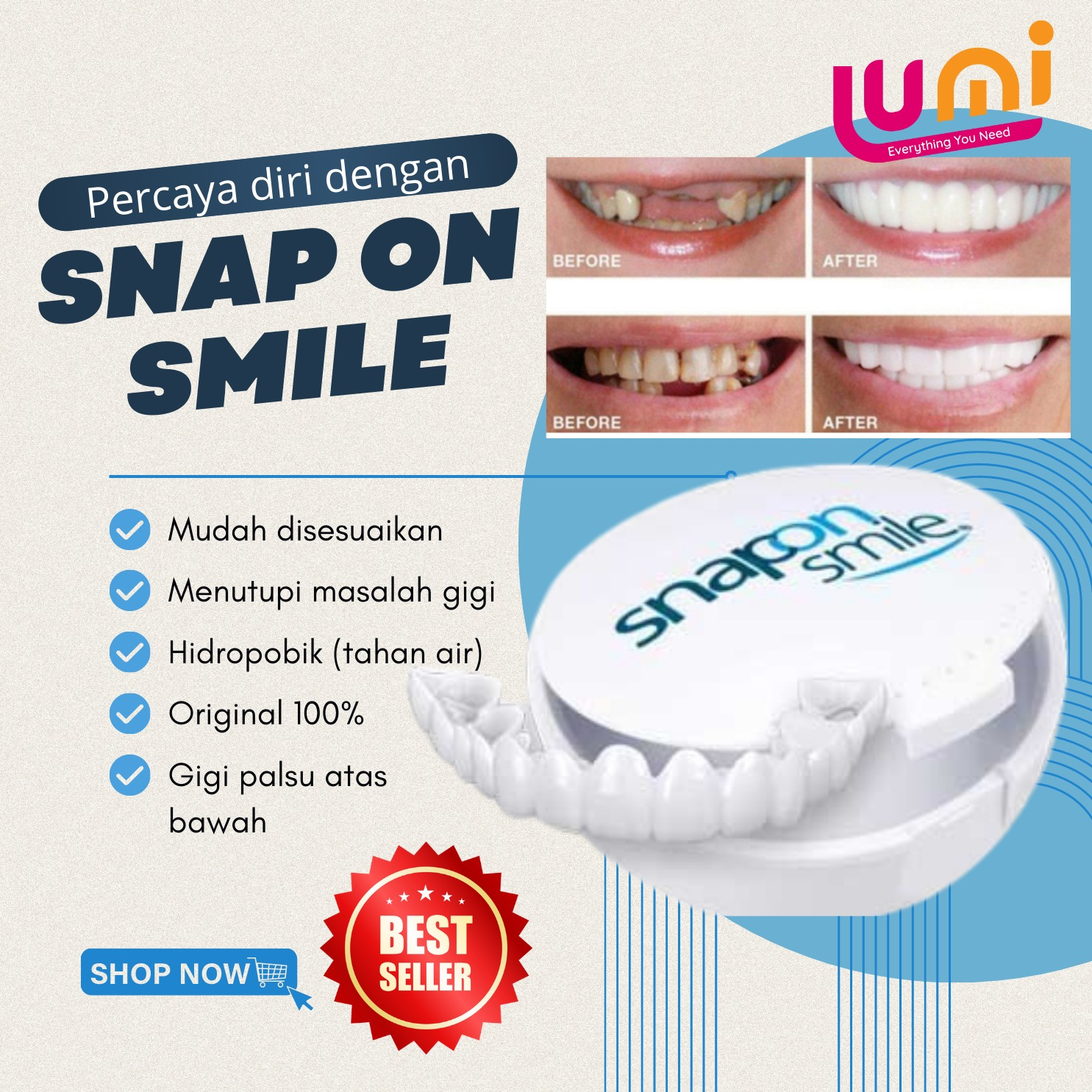 Jual Snap On Smile 100% ORIGINAL Authentic Perawatan Kesehatan Gigi Palsu Renggang Snapon Smile ...