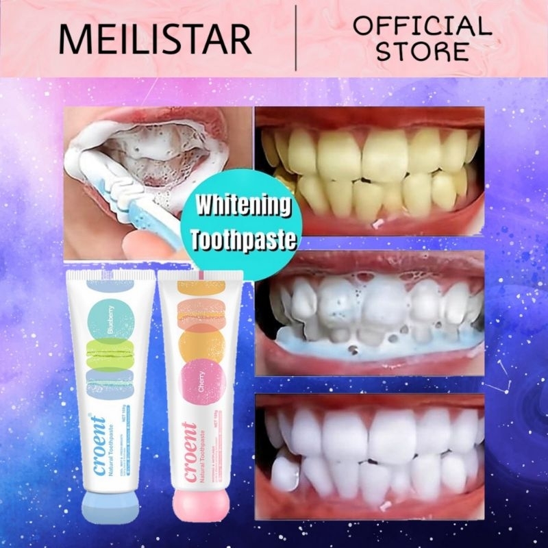 Jual CROENT Pasta Gigi Korea Macaron / Whitening Toothpaste Cherry ...