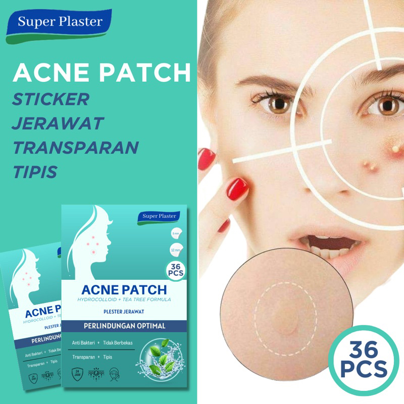 Jual Plester Jerawat Acne Patch 36 Pcs - Penghilang Jerawat Acne ...