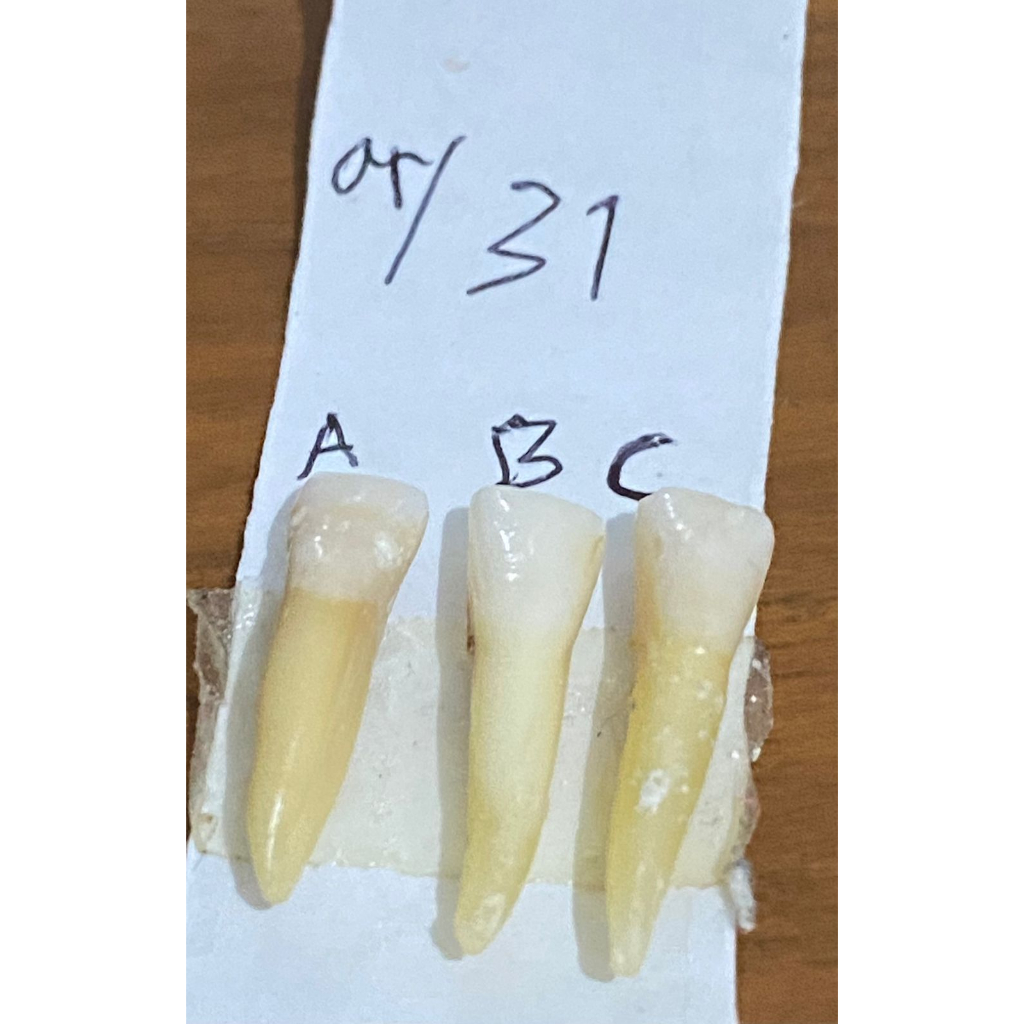 Jual INSISIVUS 1 RB 31 (GIGI PRAKTIKUM FKG) | Shopee Indonesia