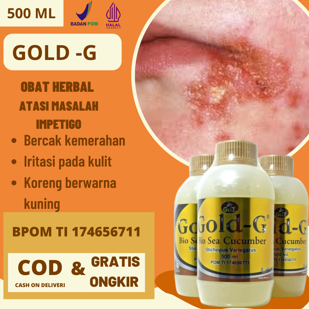 Jual Obat Impetigo Anak Terlengkap & Harga Terbaru Mei 2026 | Shopee ...