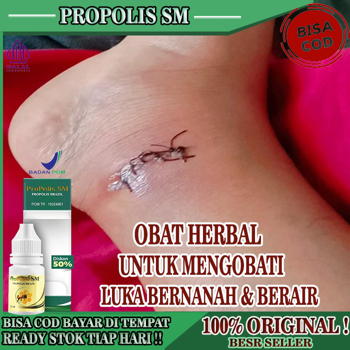 Jual Obat Oles Pengering Luka Bernanah & Berair Alami, Obat Luka ...
