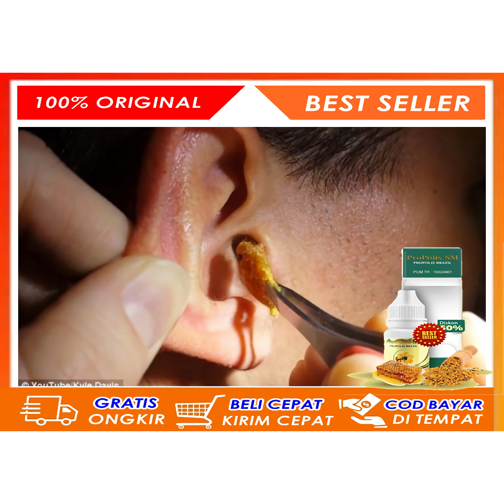 Jual Obat Telinga Bernanah Menahun, Congek, Curek, Budek, Telinga ...