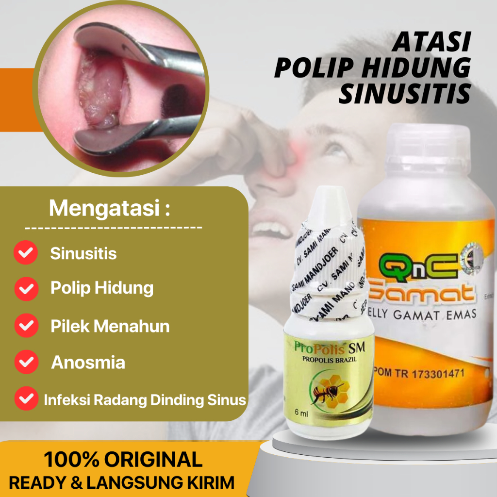 Jual Propolis SM - Obat Polip hidung, Pembersih Hidung Bau Busuk Sering ...