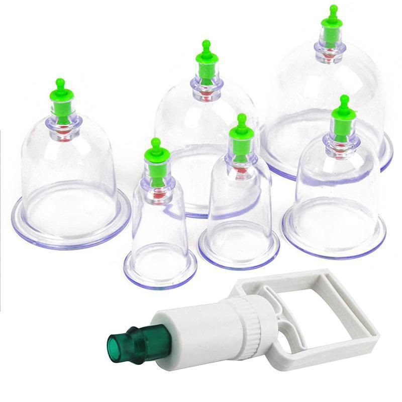 Jual Kop Angin Alat Bekam Untuk Mengobati Masuk Angin & Kesehatan Badan Lengkap Isi 6 Cup ...