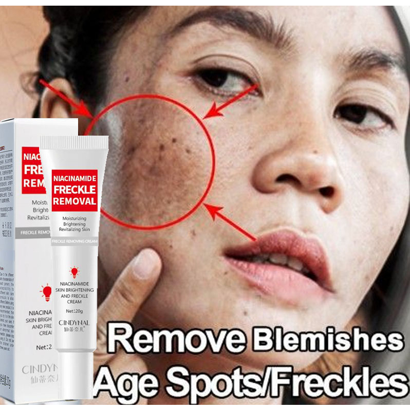 Jual NEW CINDYNAL Dark Spots Flek Hitam Krim Perawatan Kulit Pemutih Efektif Pigmentasi ...