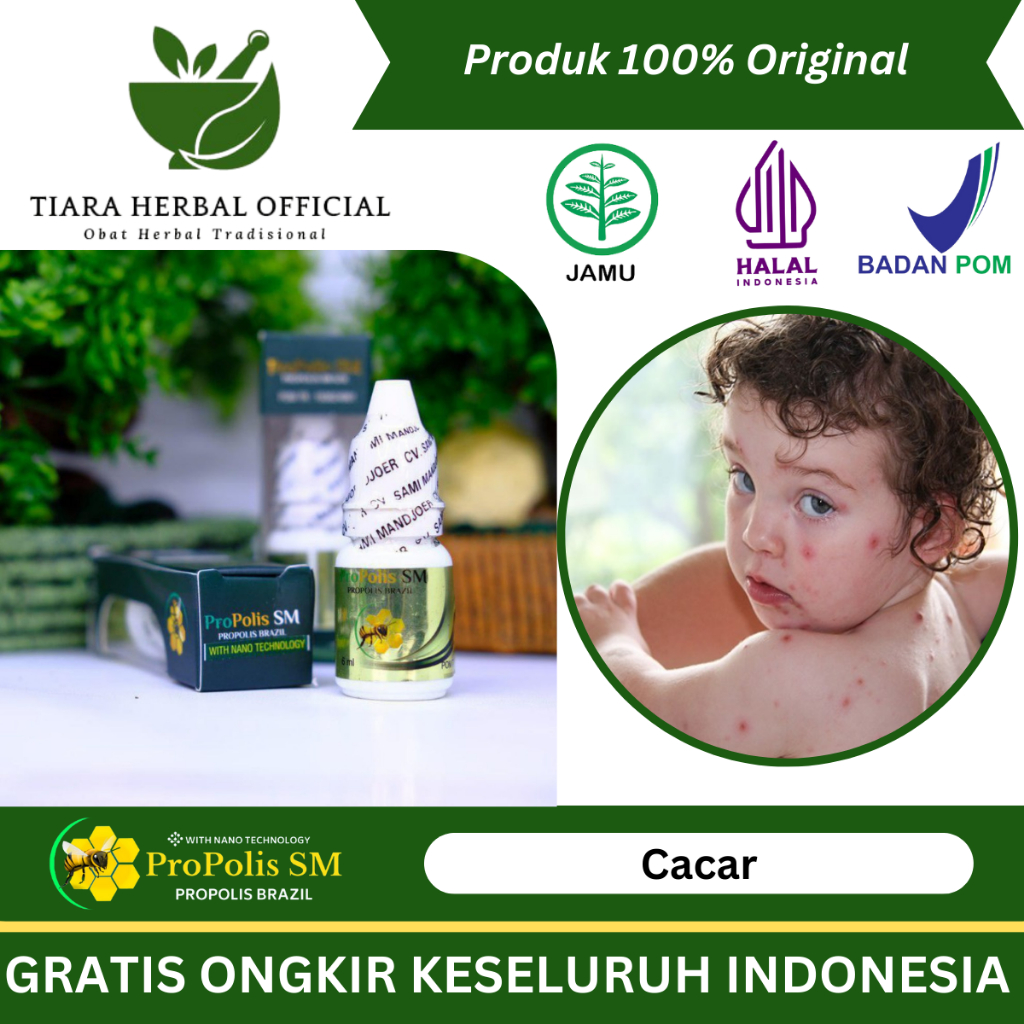 Jual Obat Cacar Air, Obat Penghilang Bekas Luka Cacar, Obat Cacar Api ...