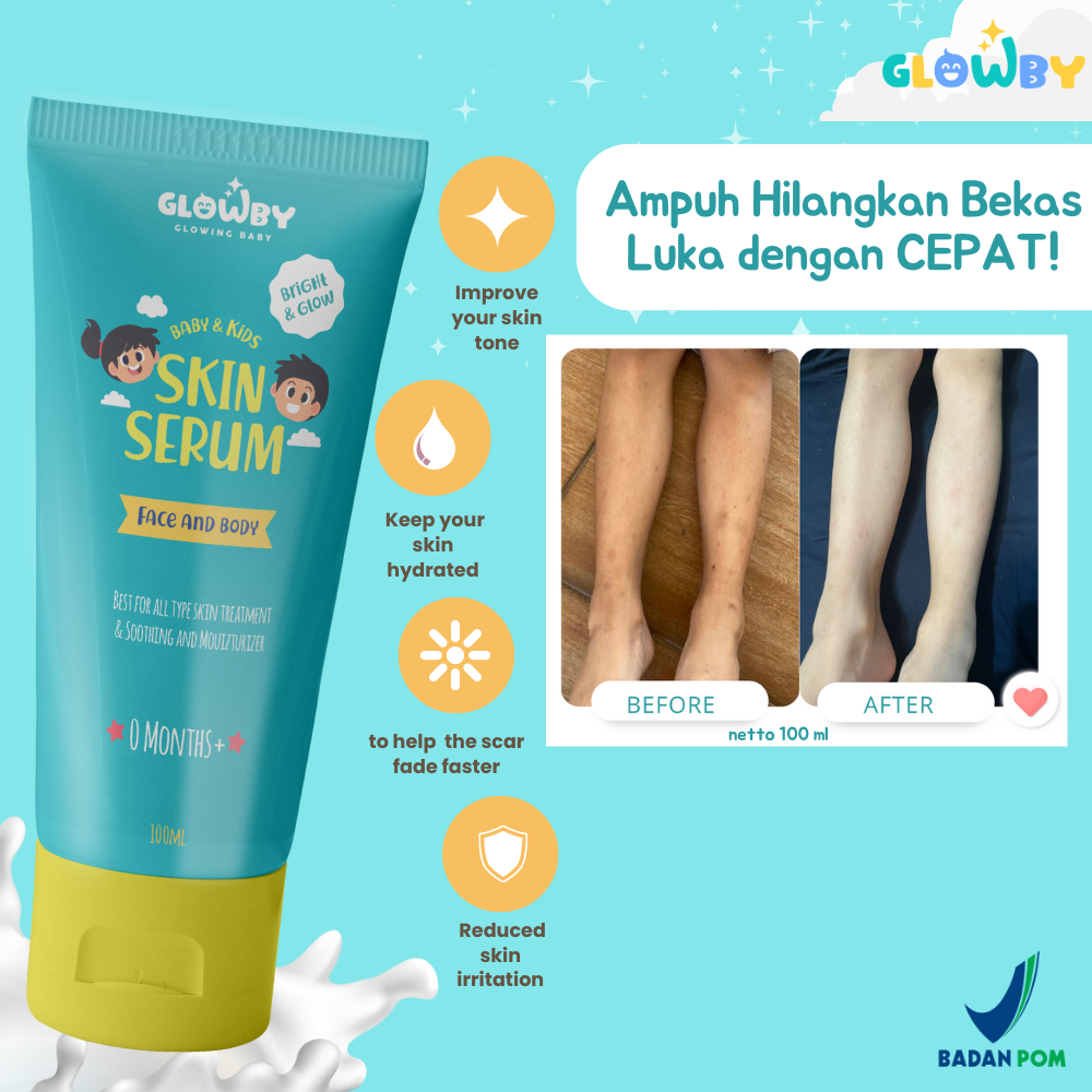 Jual (GLOWBY) Serum Lotion Mencerahkan dan Penghilang bekas luka Anak ...