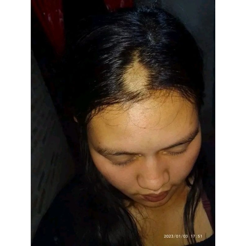 Jual castor oil penumbuh rambut pitak botak dan kerontokan | Shopee ...