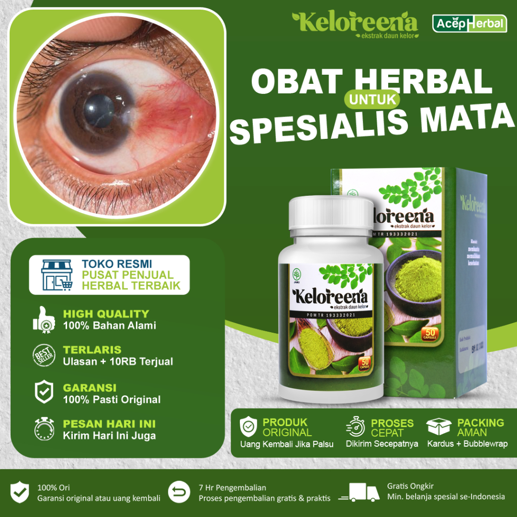 Jual Obat Mata Berlemak Ptregium Kekuningan Vitamin Untuk Mata ...