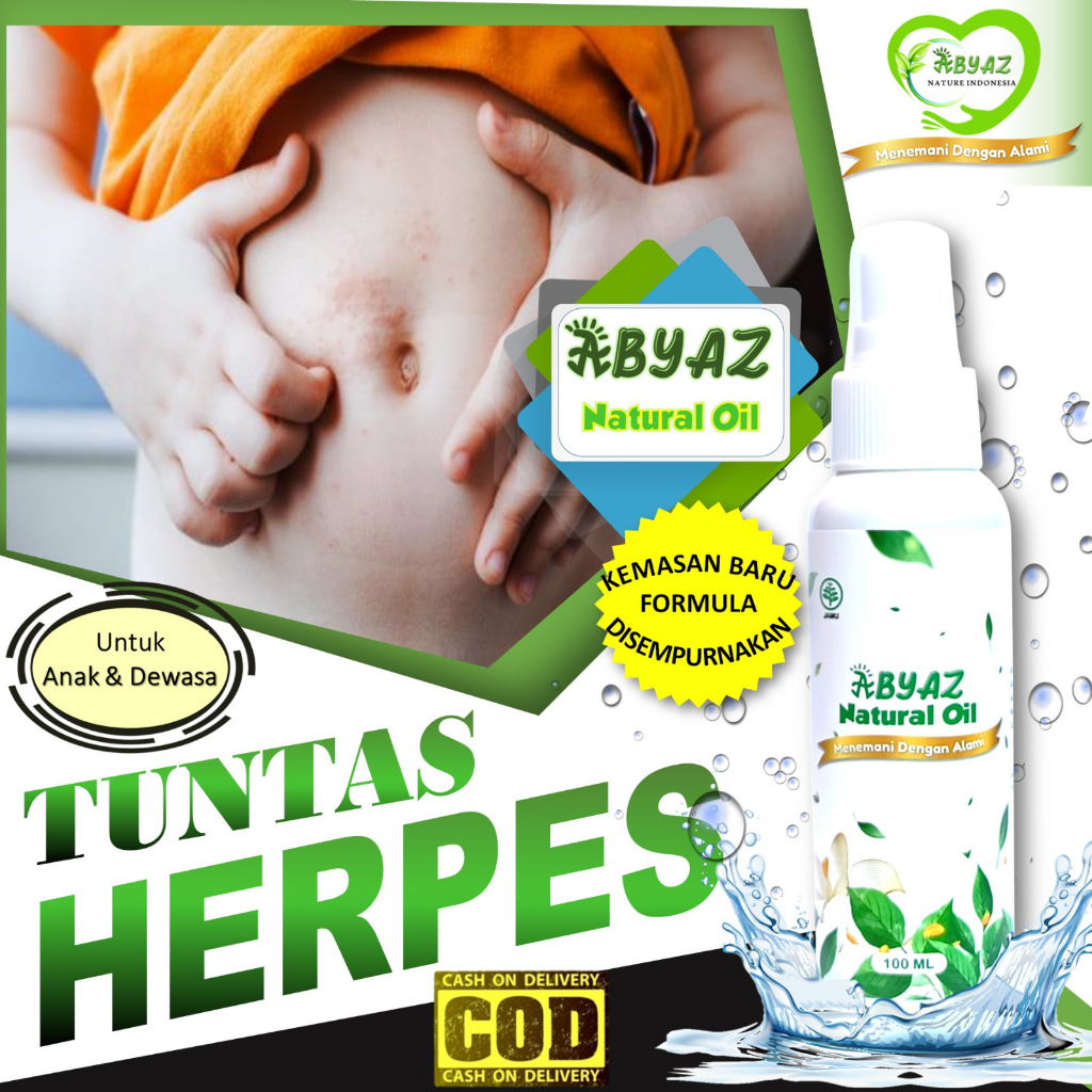 Jual OBAT HERPES SCABIES GATAL DERMATITIS EKSIM ALERGI BIDURAN JAMUR ...