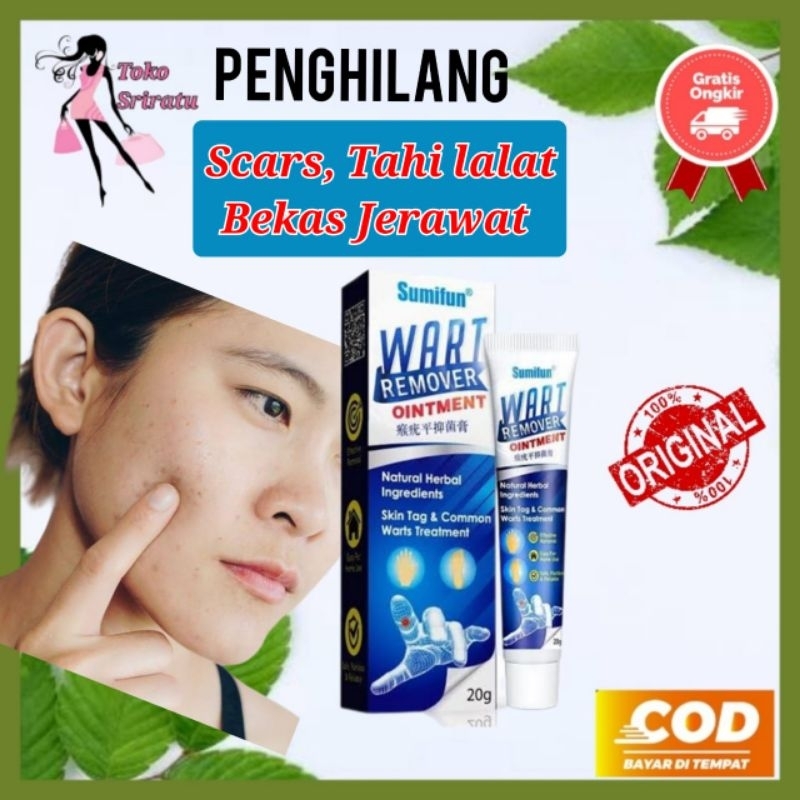 Jual SKIN TAG REMOVER Menghilangkan Kutil Tahi Lalat Mata Ikan ...