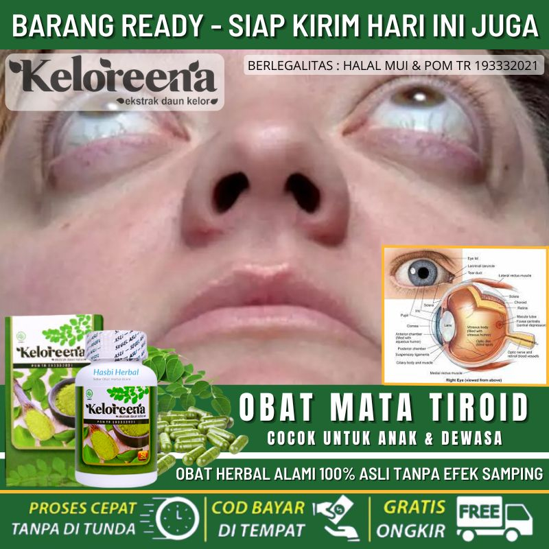 Jual Obat Herbal Bola Mata Menonjol Abnormal, Obat Kelainan Mata Pada ...