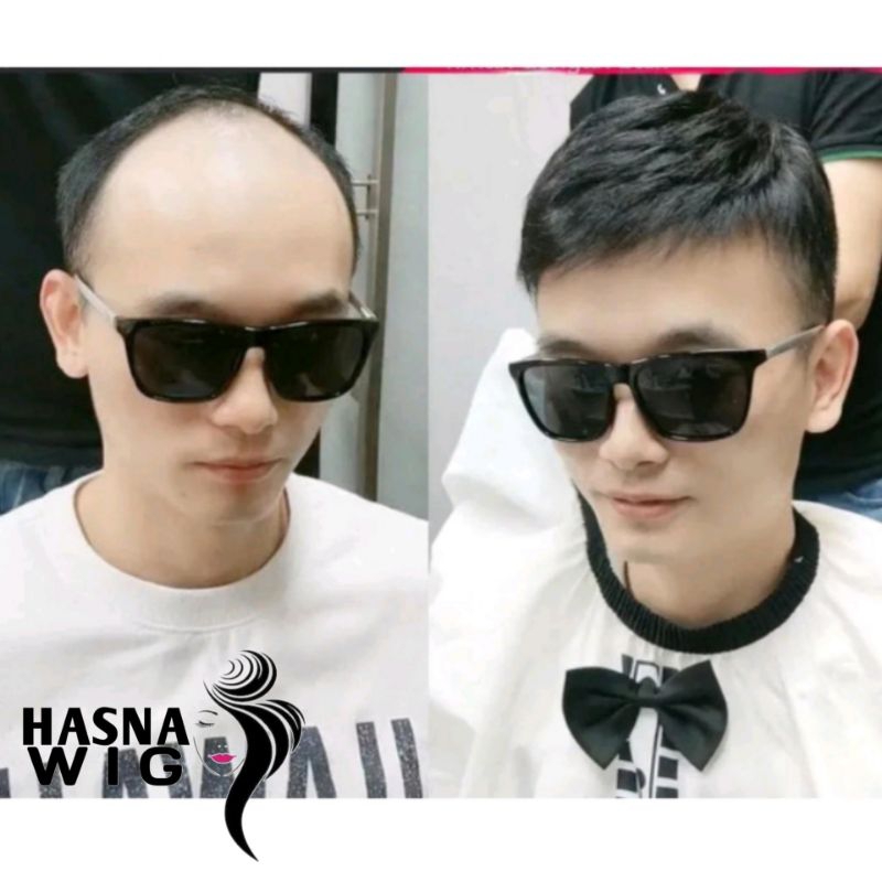 Jual Wig Penutup Botak Model Rambut Tipis Versi Pria Korea | Shopee ...