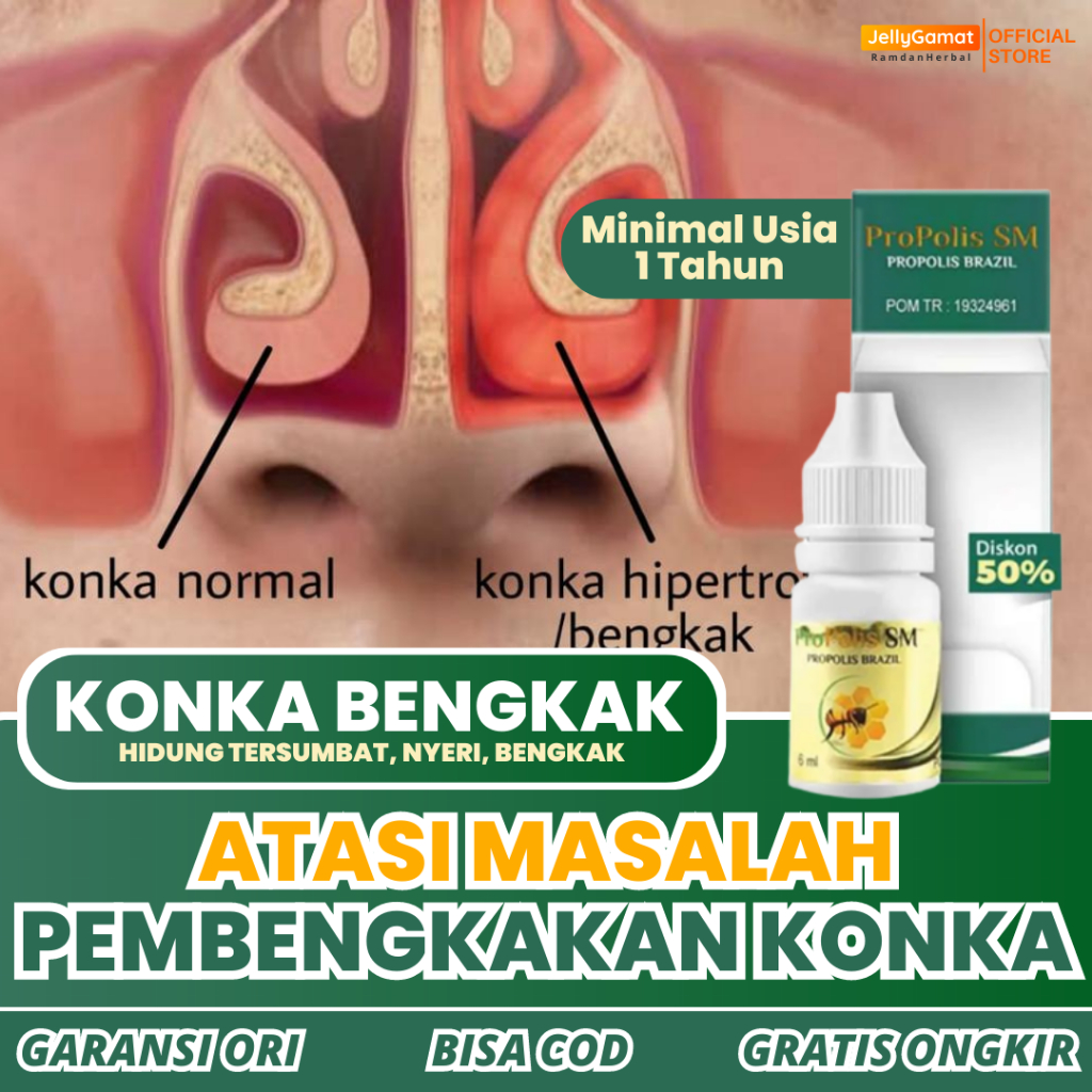 Jual Obat Konka Bengkak Hipertrofi Konka Pembengkakan Hidung Tersumbat ...